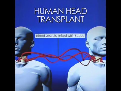 World’s First Complete Human Head Transplant This Year - Guys World